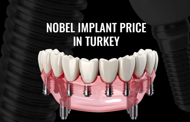 What is Zygomatic Dental Implant? - International Plus | Turkey | Istanbul