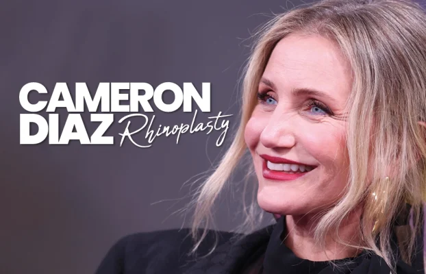 Trump Teeth Before and After 2025 - International Plus