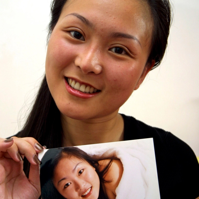 Hao Lulu Plastic Surgery - International Plus