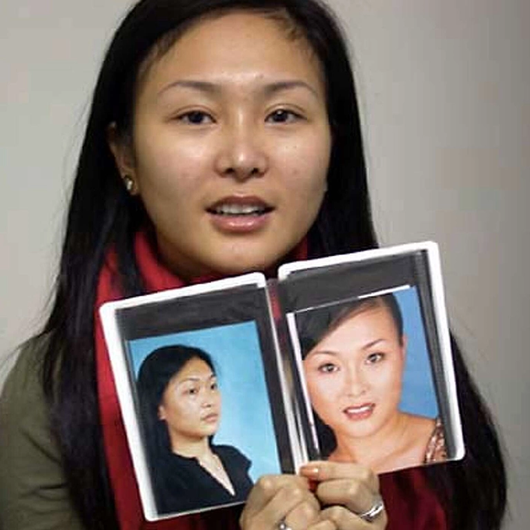 Hao Lulu Plastic Surgery - International Plus