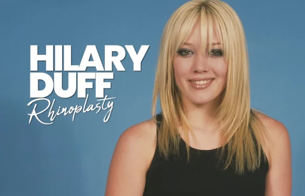 Pamela Anderson Before and After - International Plus